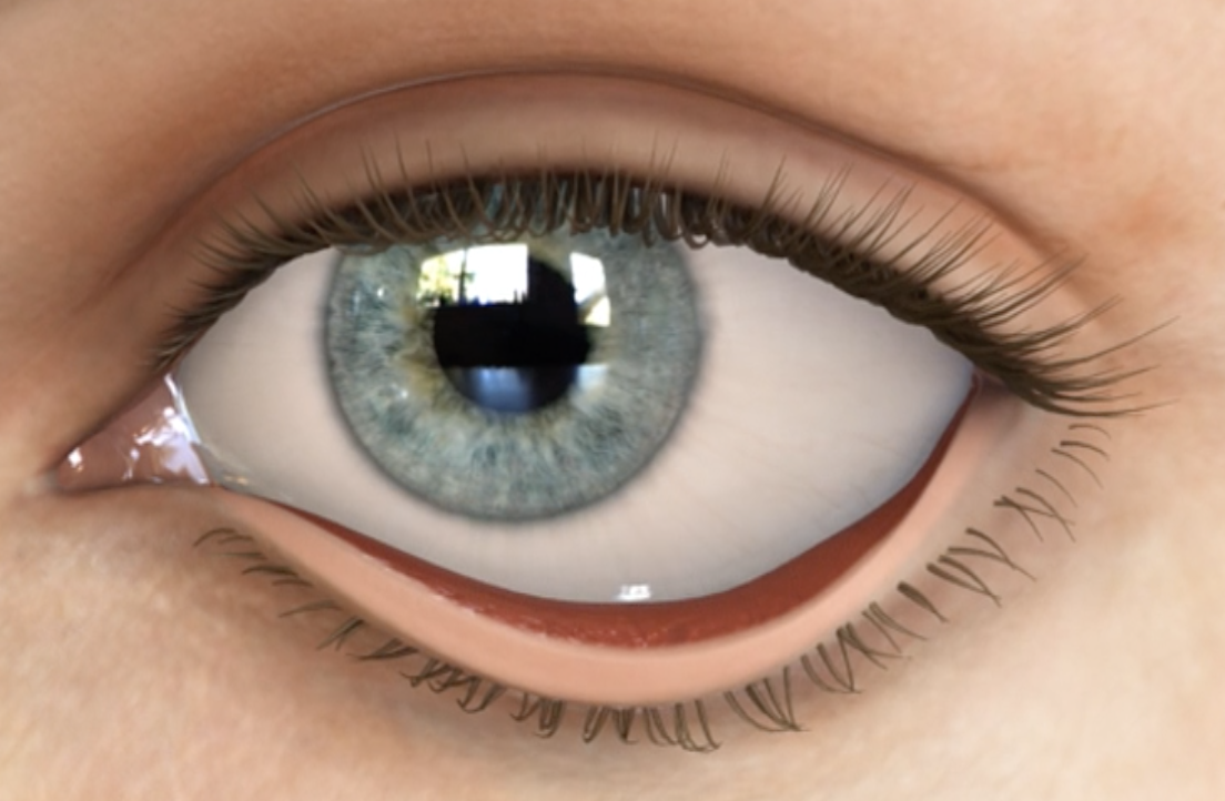 Oculoplastics - Glacier Eye